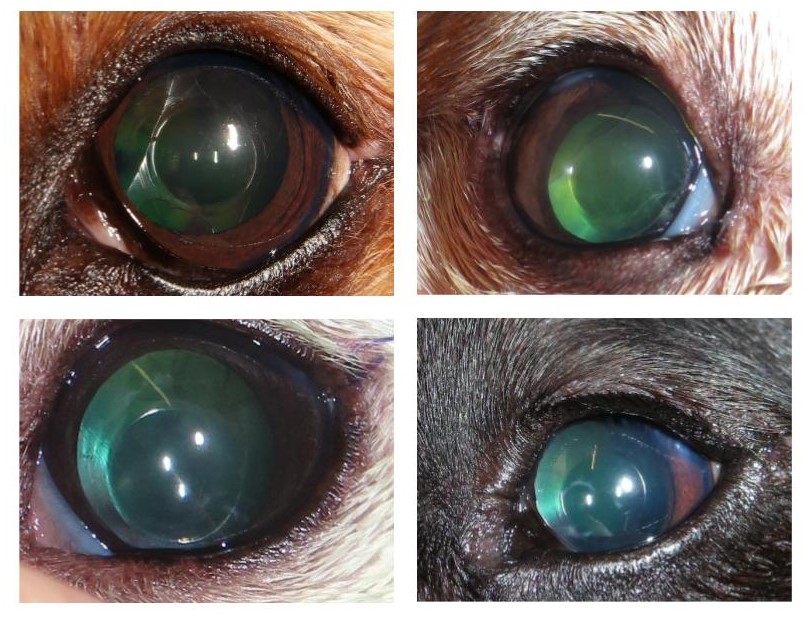 Cataracts, what are they? - Bridge Referrals