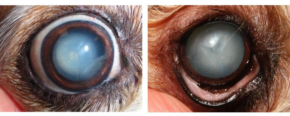 Cataracts, what are they? - Bridge Referrals