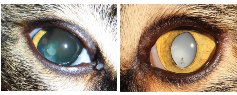 Cataracts, what are they? - Bridge Referrals