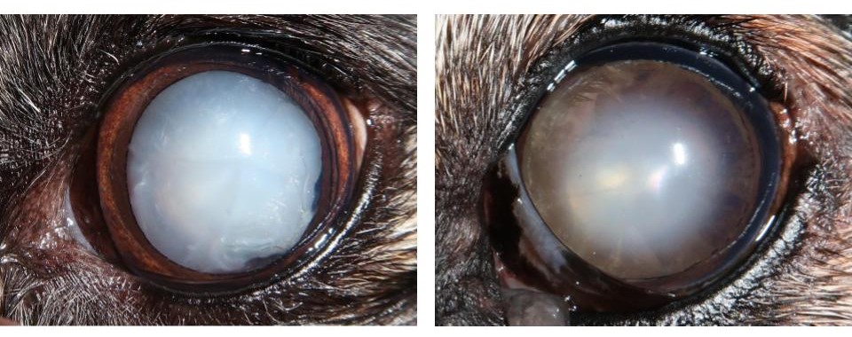 Cataracts, what are they? - Bridge Referrals